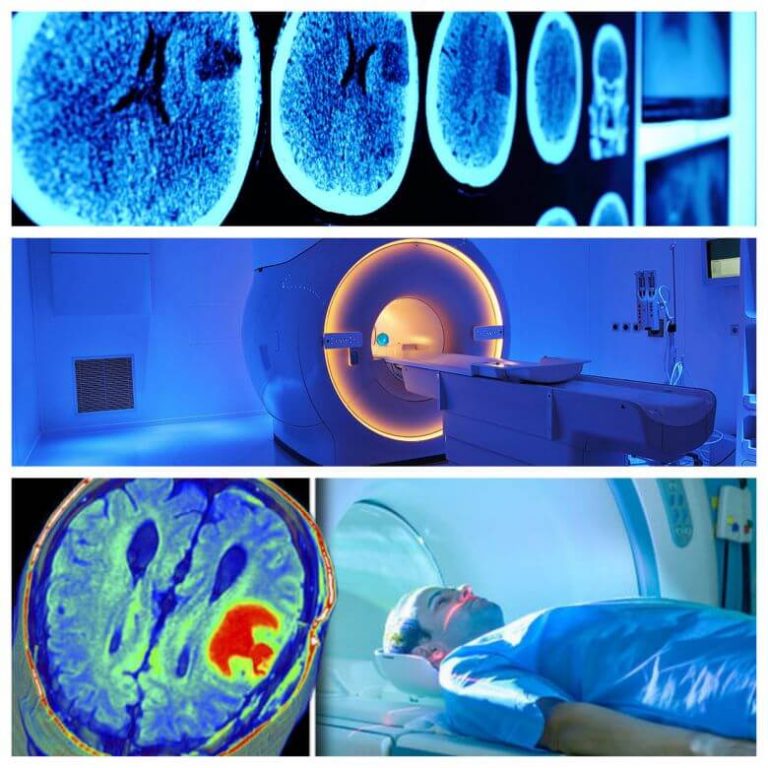 ام ار ای MRI / عوارض ام ار ای / انواع ام ار ای / هزینه ام ار ای - اعتماد مگ